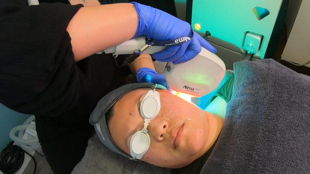 Intense Pulse Light (IPL) - Catch the wave at IMI Clinics