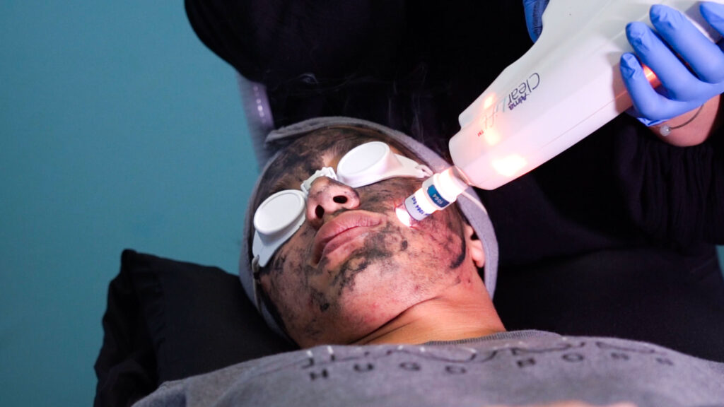 Clearlift: Non-ablative skin resurfacing - Catch the wave at IMI Clinics