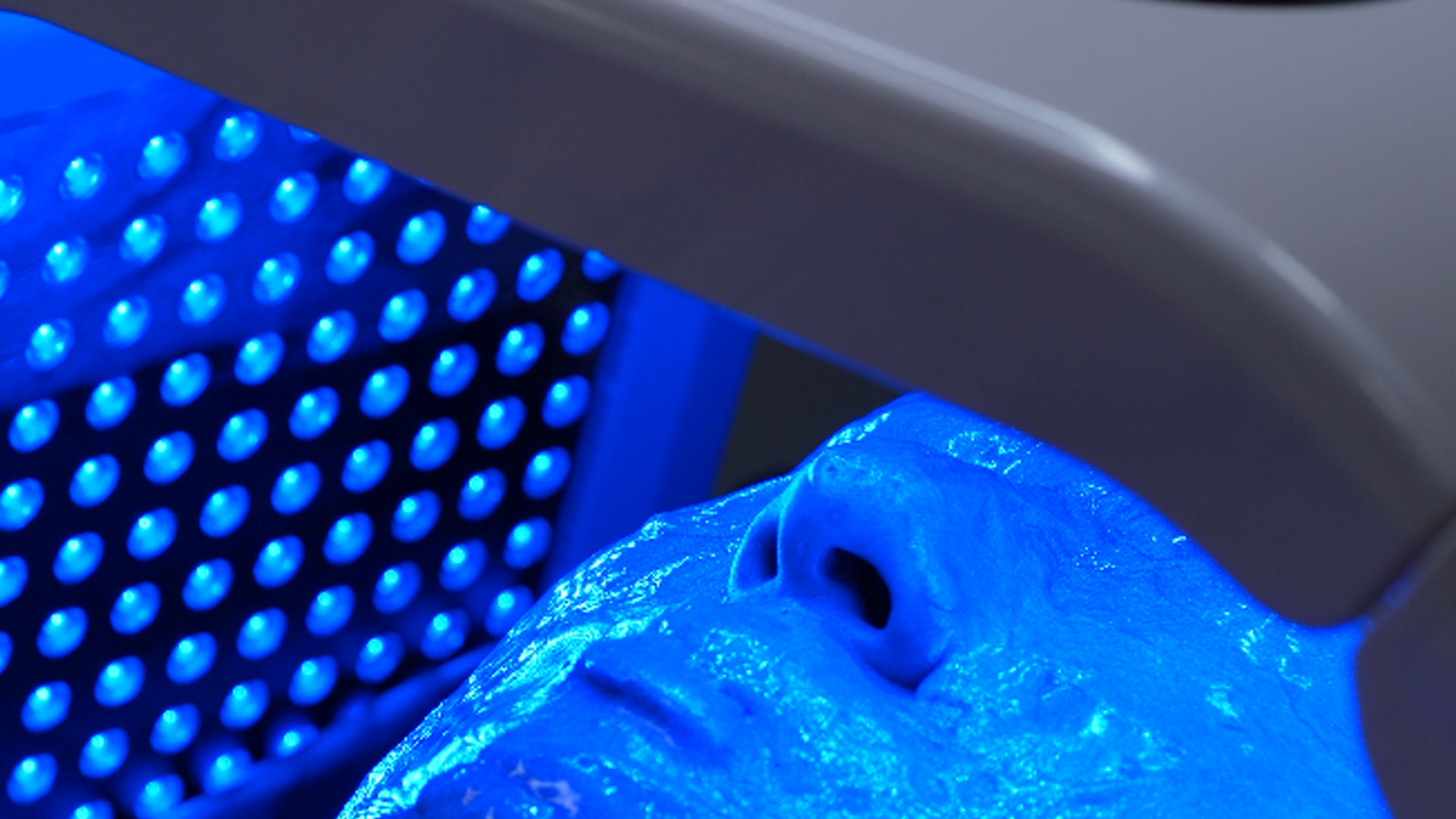 Clear Skin Awaits with Blue Light LED! - Catch the wave at IMI Clinics